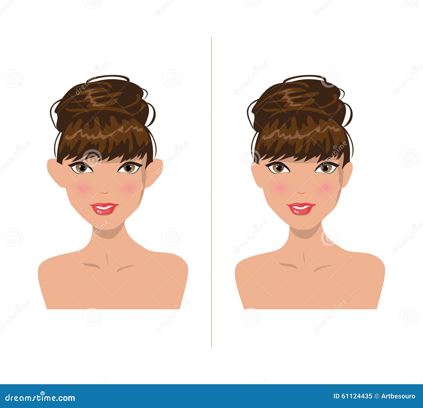 Otoplasty. Vector Illustration Stock Vector - Illustration of patient ...
