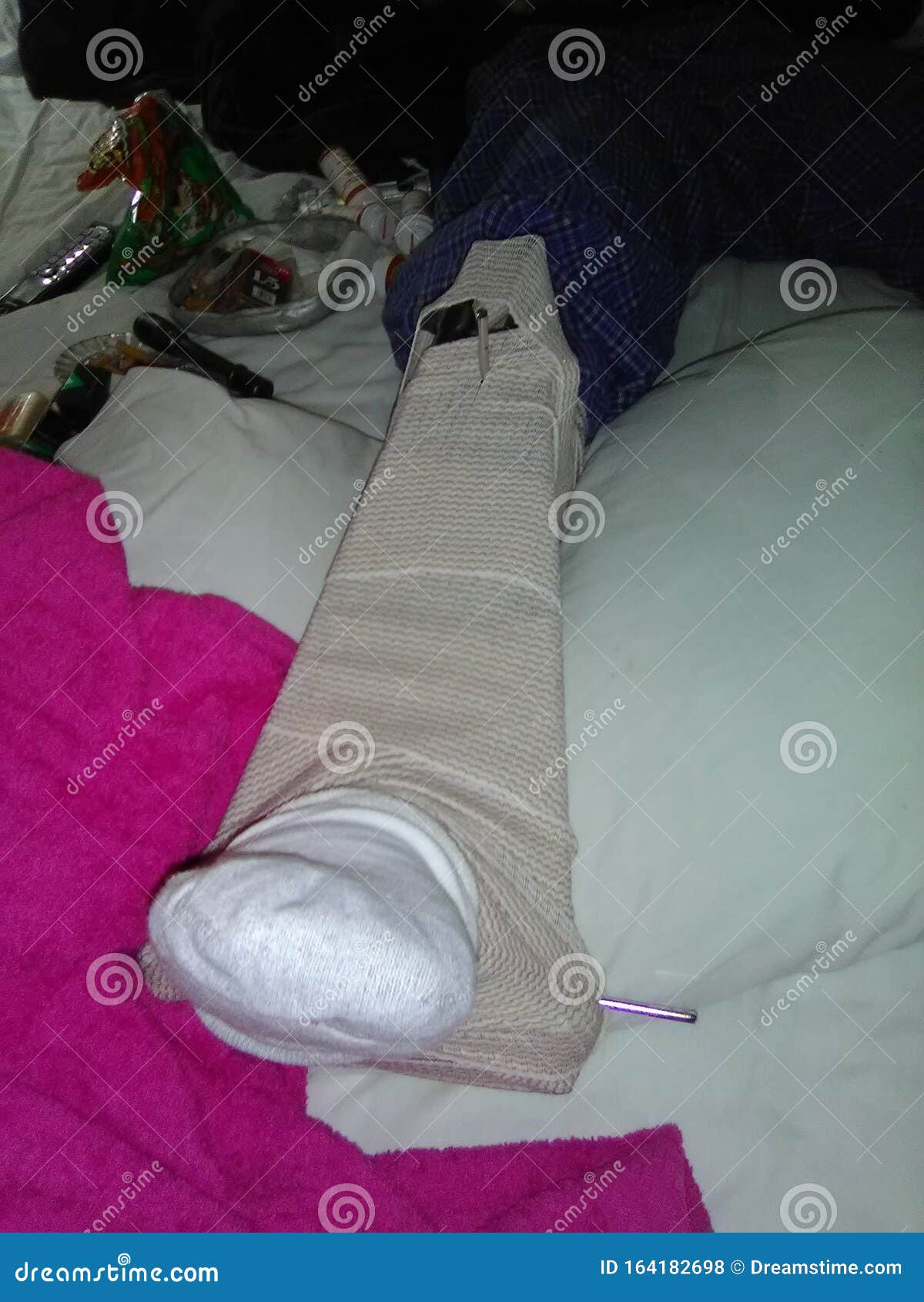 Ouch stock photo. Image of surgery, hurt, broke, ouch - 164182698