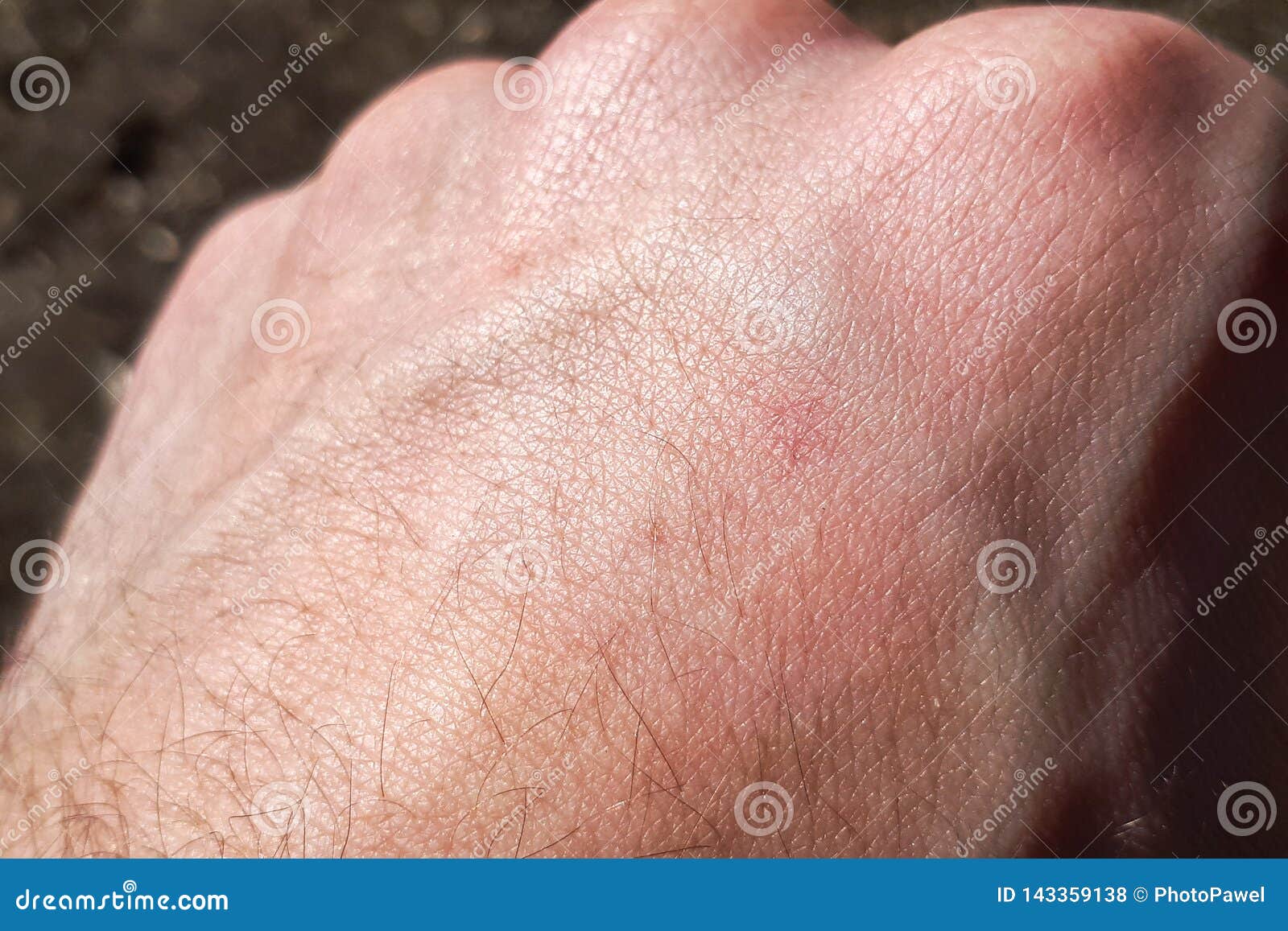 Outer Part of the Human Hand. Close-up Human Skin on the Palm Stock ...