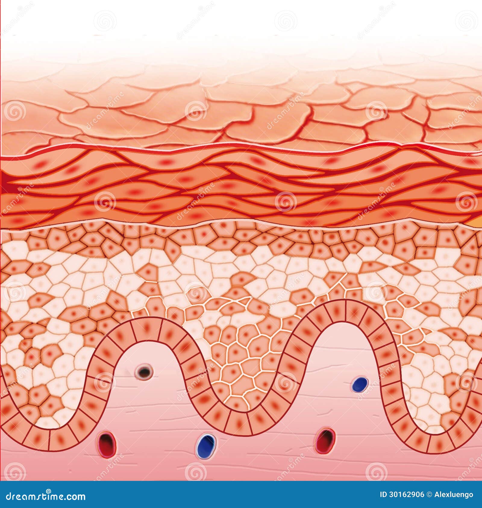Darier skin disease stock illustration. Illustration of ears - 30162906
