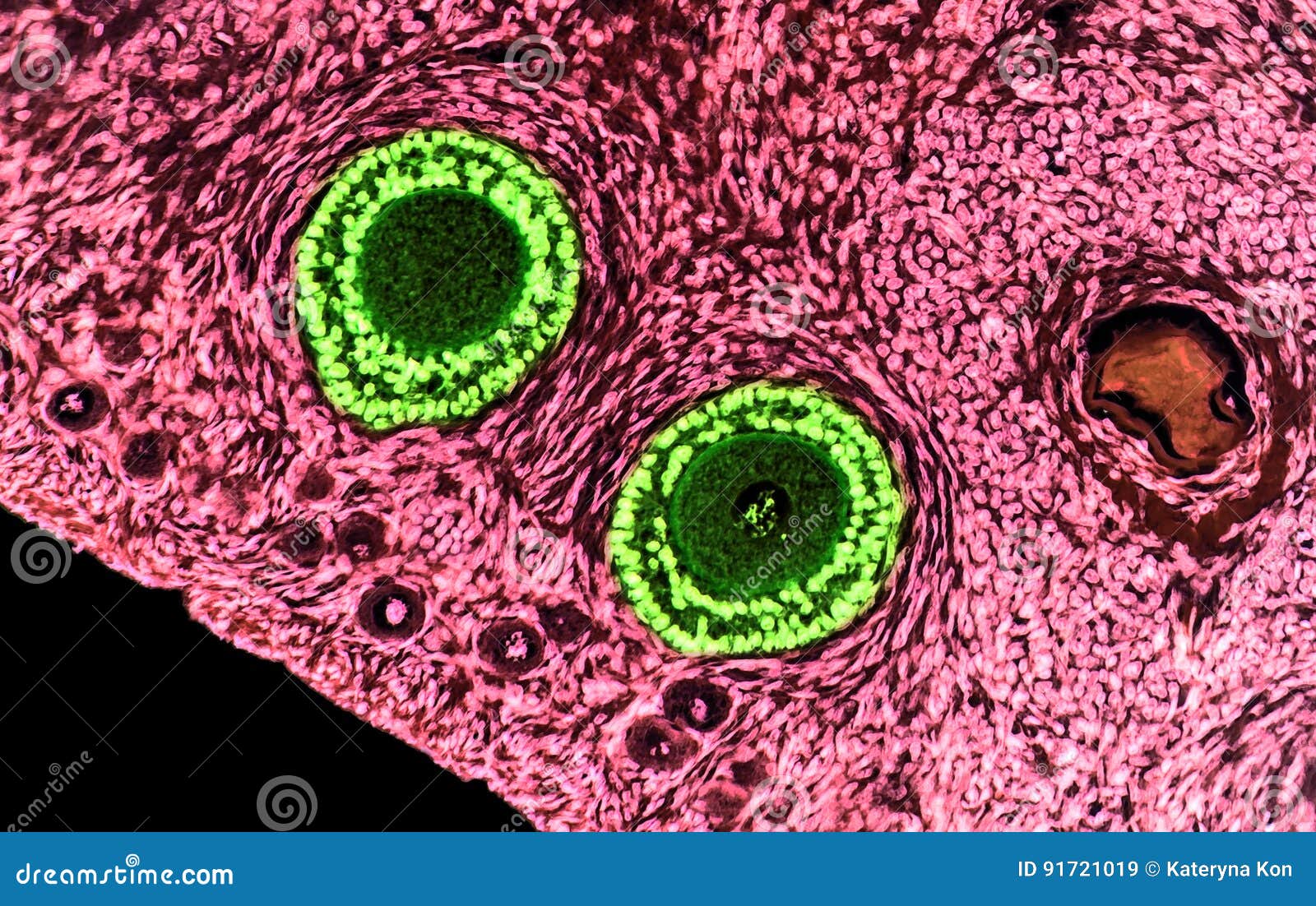 Ovarian Follicles. Light Microscopy Stock Image - Image of ovarian ...