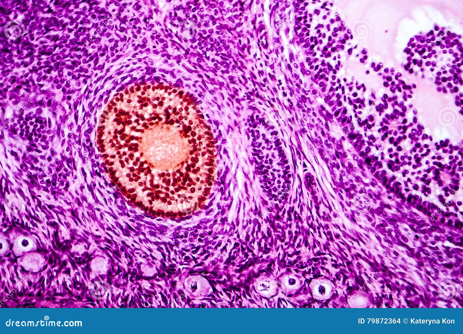 Light micrograph of ovary stock illustration. Illustration of oocytes ...
