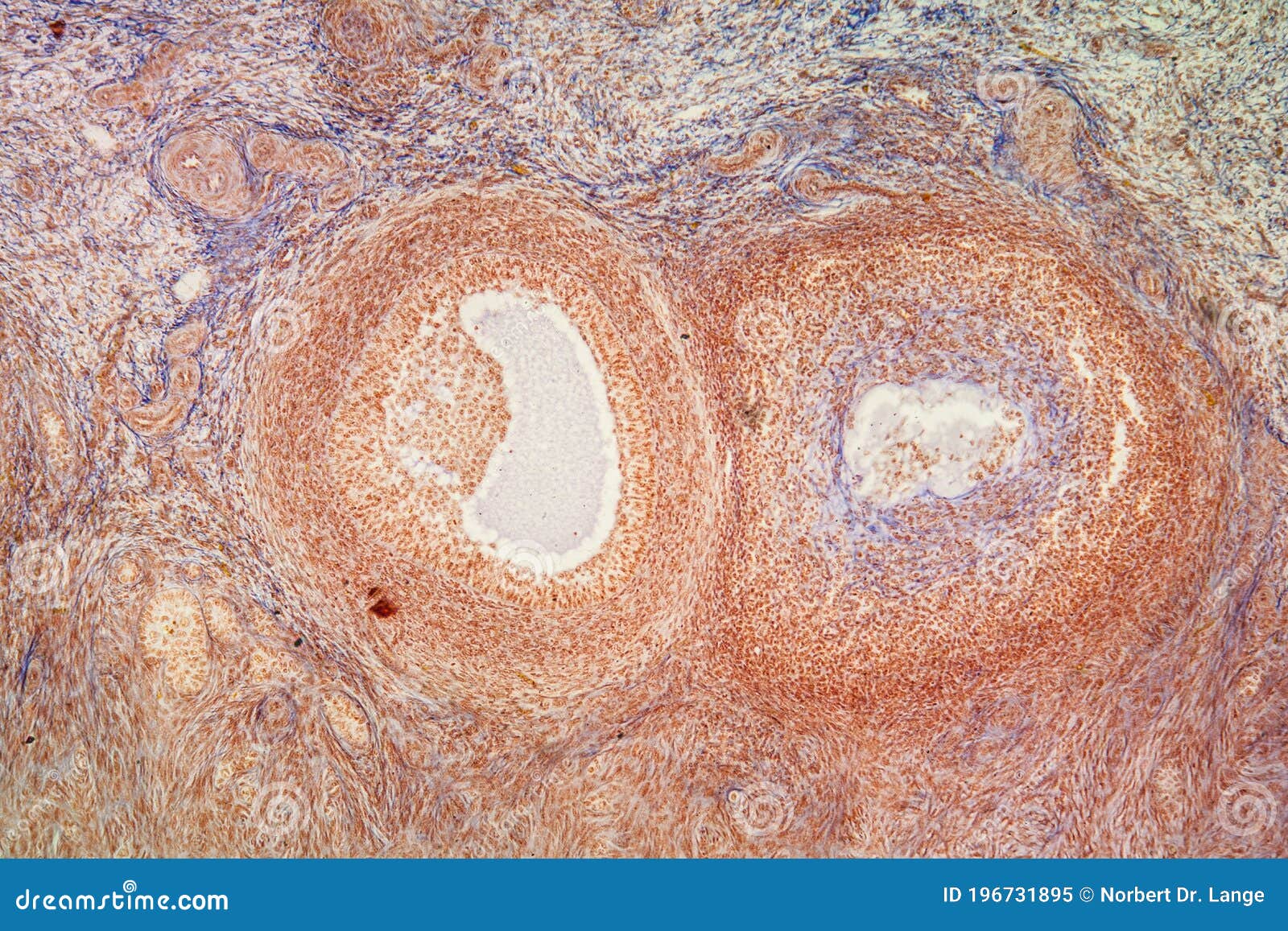 Ovarian tissue stock image. Image of medicine, enlargement - 196731895