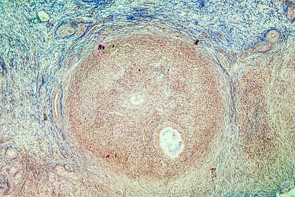 Ovarian tissue stock photo. Image of eggs, ovarian, magnification ...