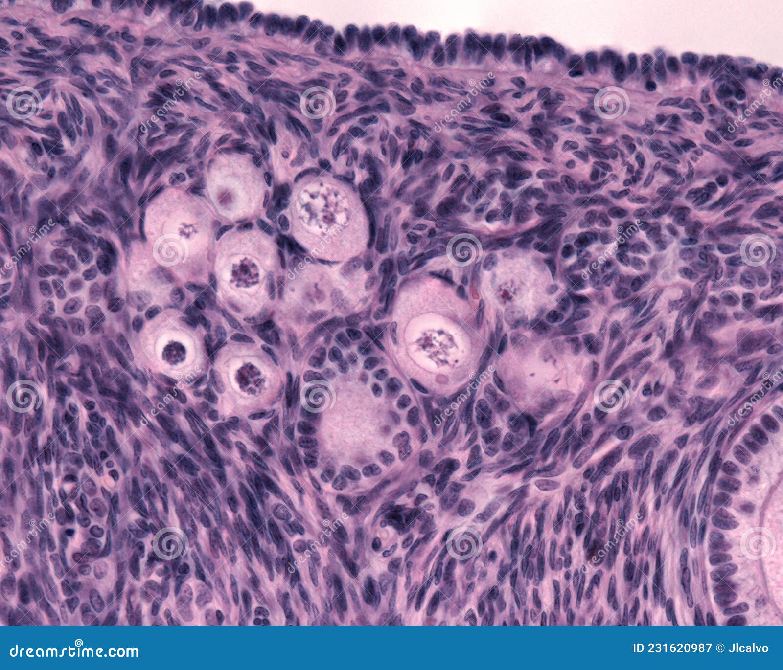 Ovary Primordial Follicles Stock Image Image Of Reproductive Oocyte