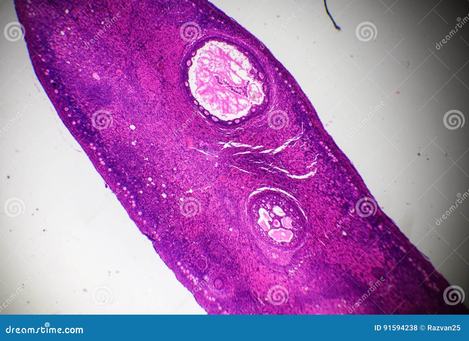 Ovary Section Under the Microscope Stock Photo - Image of human, pelvic ...
