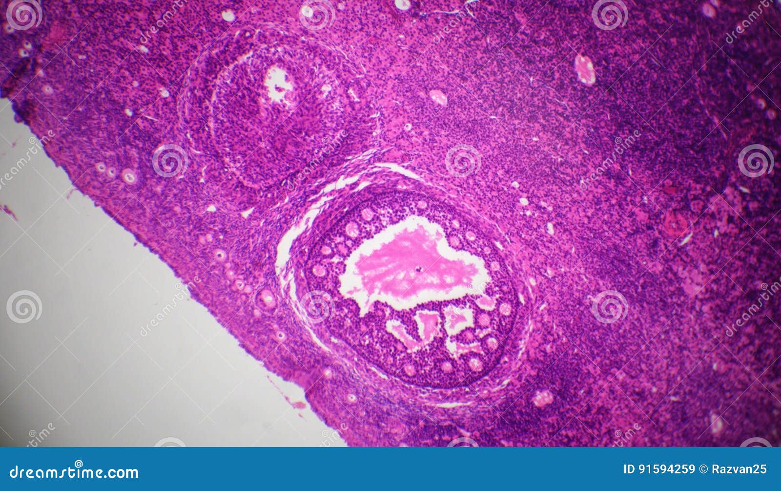 Ovary Section Under the Microscope Stock Image - Image of biology ...