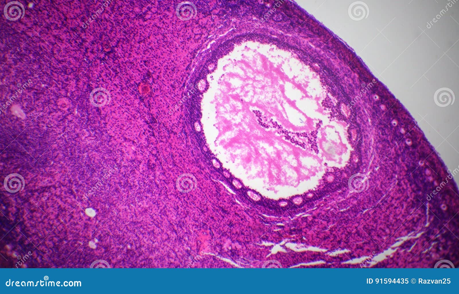 Ovary Section Under the Microscope Stock Image - Image of biology ...