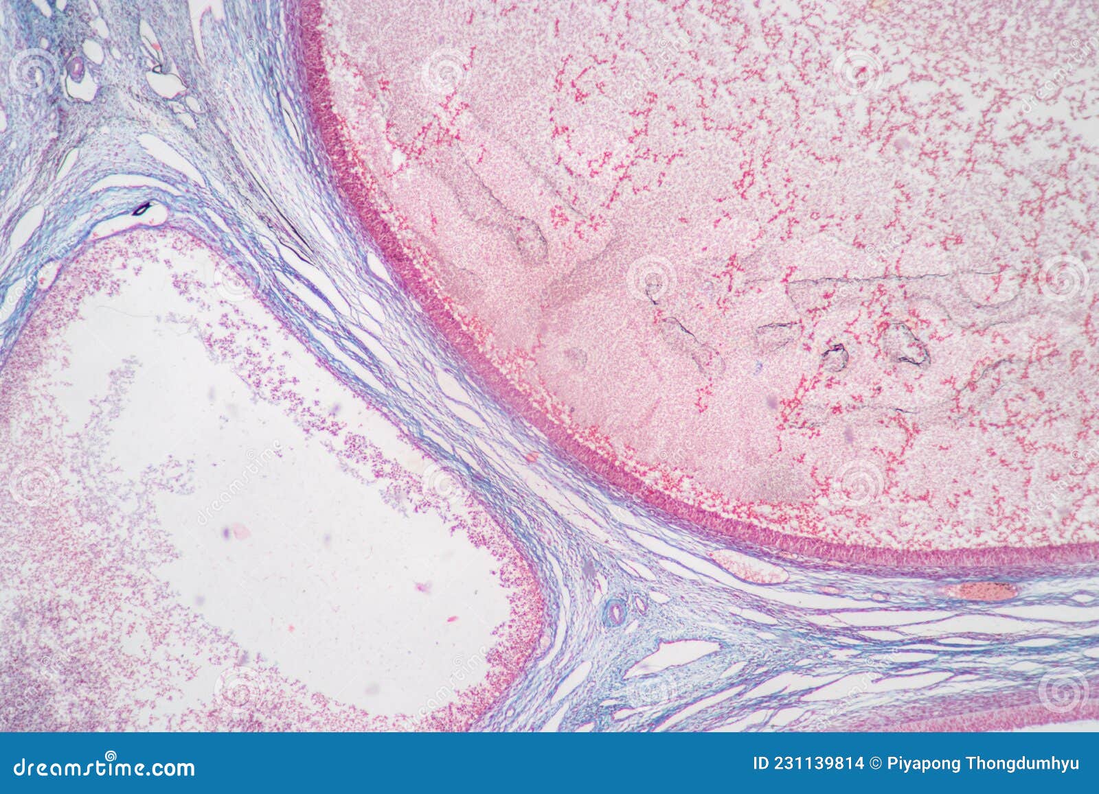 Ovary and Testis Human Cells Under Microscope. Stock Photo - Image of ...