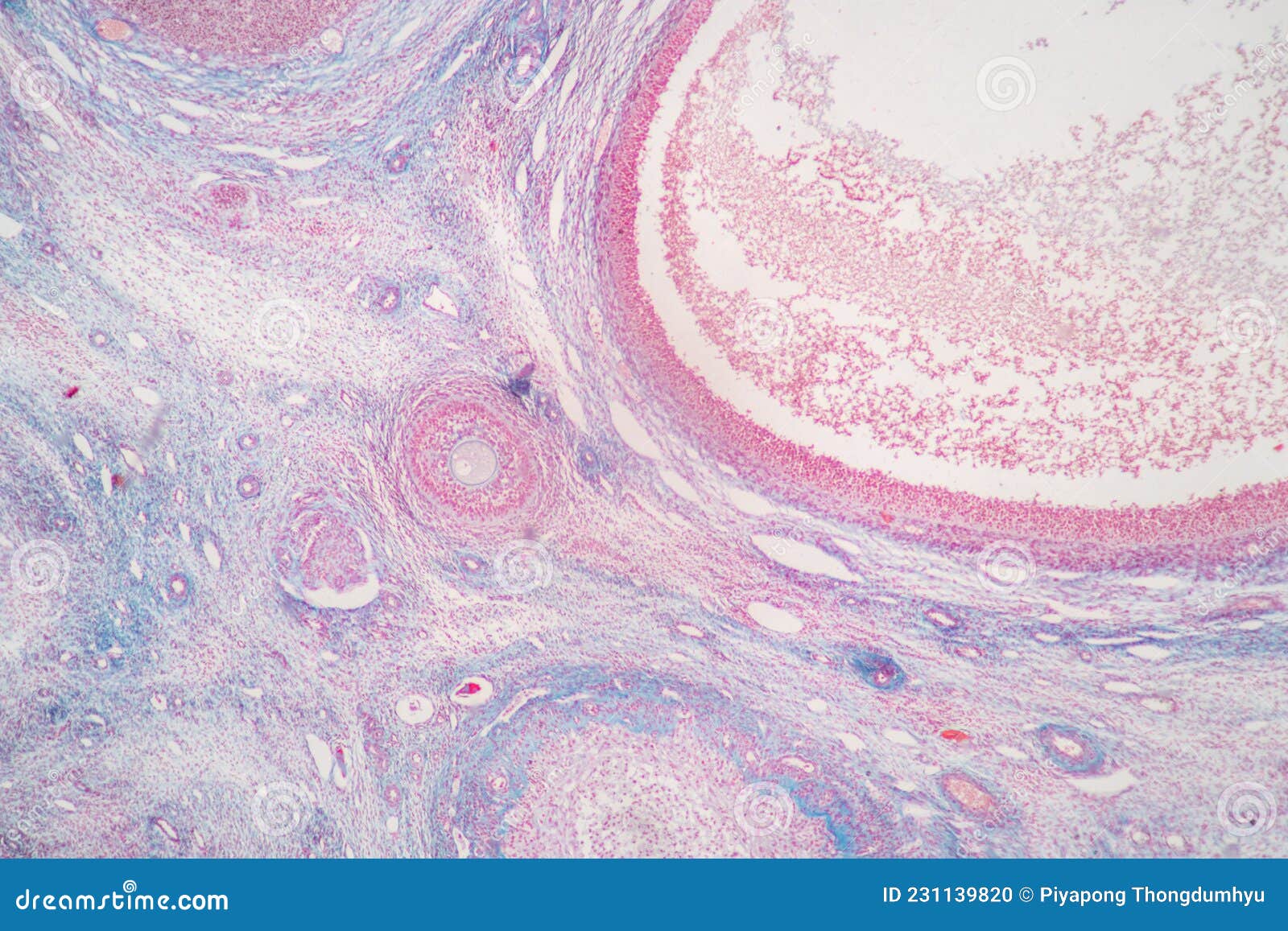 Ovary and Testis Human Cells Under Microscope. Stock Photo - Image of ...