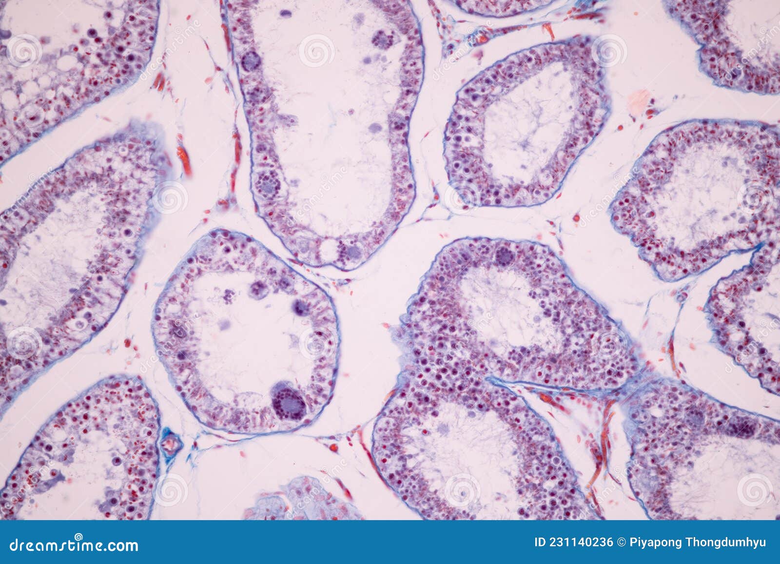 Ovary and Testis Human Cells Under Microscope. Stock Photo - Image of ...