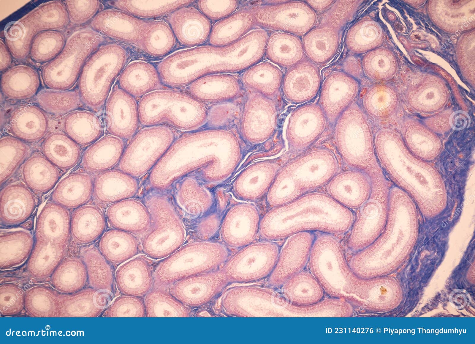 Ovary and Testis Human Cells Under Microscope. Stock Photo - Image of ...
