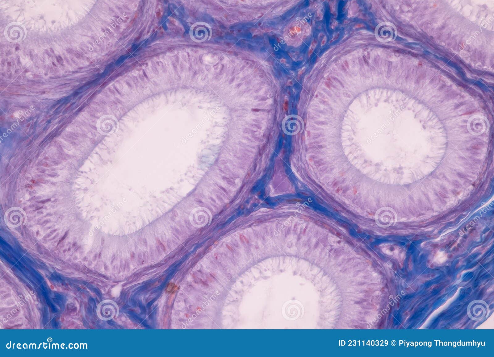 Ovary and Testis Human Cells Under Microscope. Stock Image - Image of ...