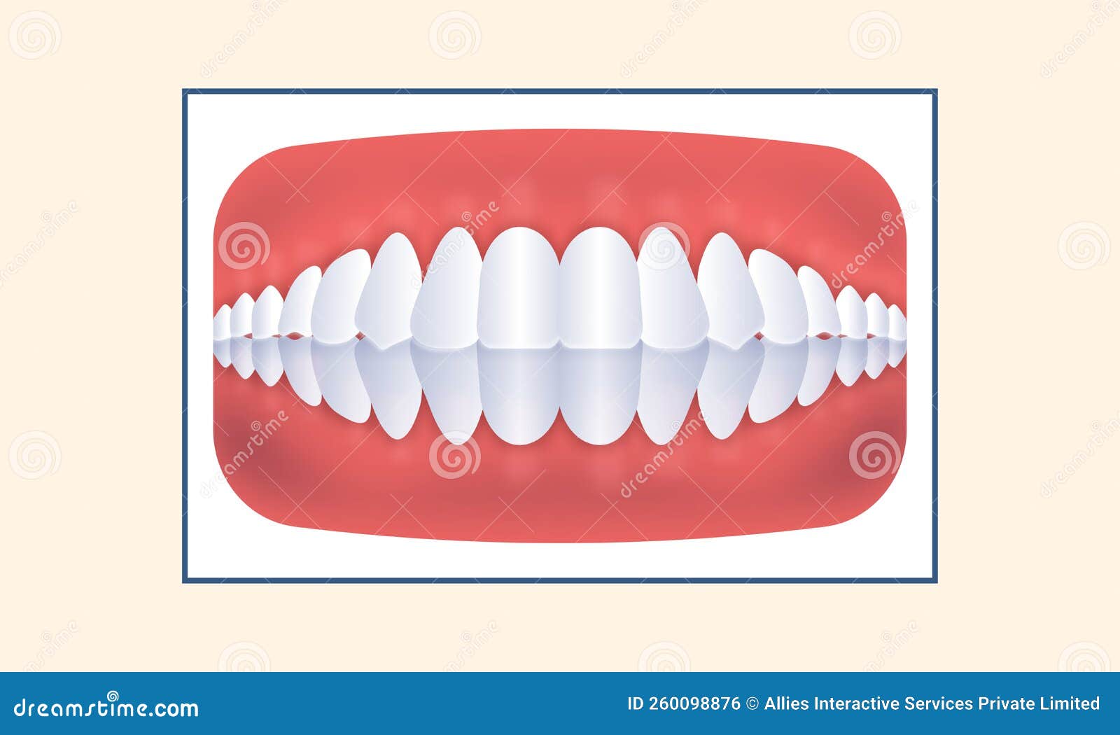 Overbite Cartoon Vector | CartoonDealer.com #54183693