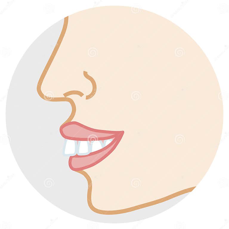 Overbite Teeth -Face Close-up, Side View Stock Vector - Illustration of ...