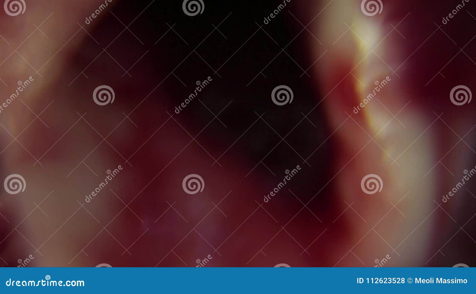 Overcranked Footage of Internal Organs Showing Elements of Blood and ...