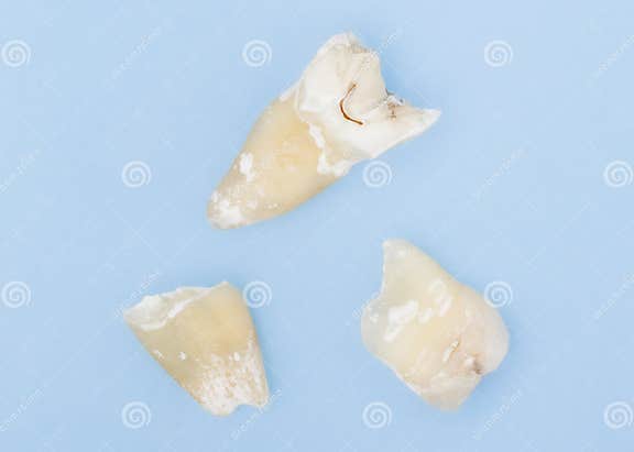 Extracted Molar Tooth on Blue Stock Image - Image of health, medicine ...