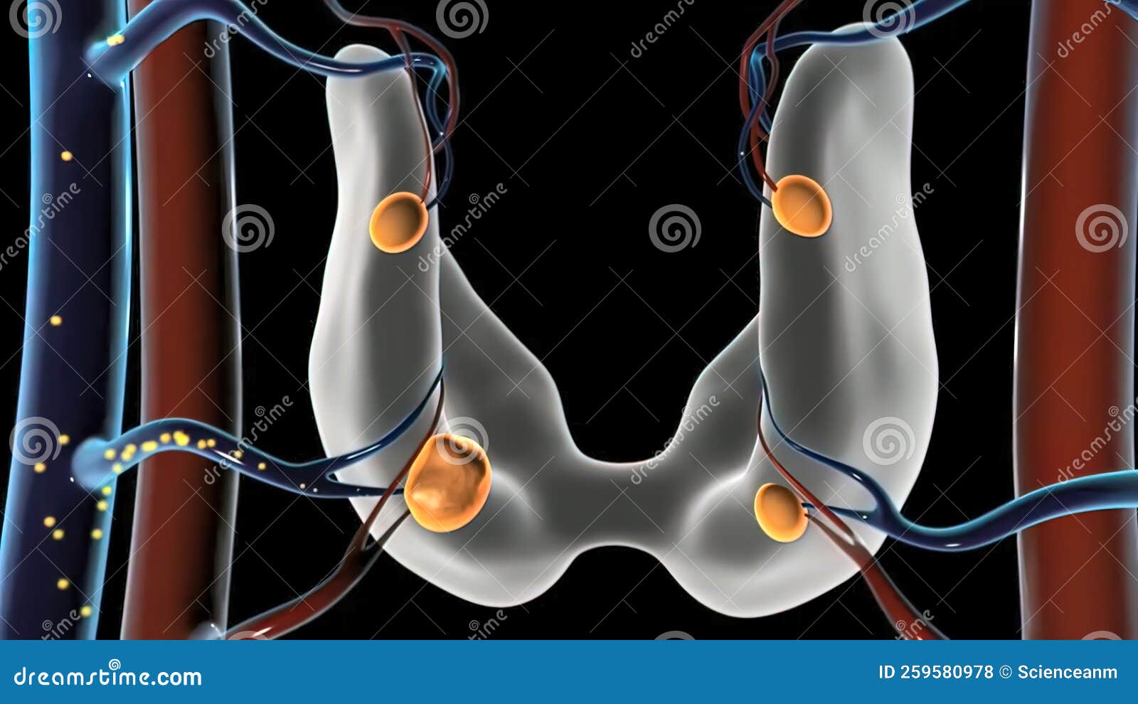 Overview of Parathyroid Disease- Tumor Growth Stock Illustration ...