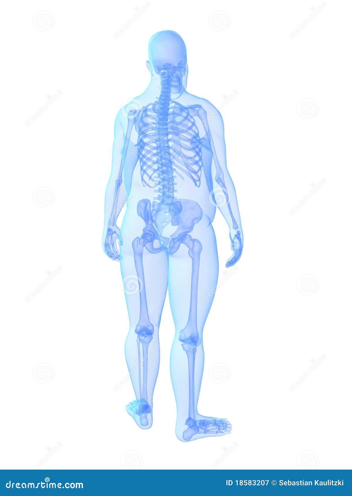 Overweight male - skeleton stock illustration. Illustration of painful ...