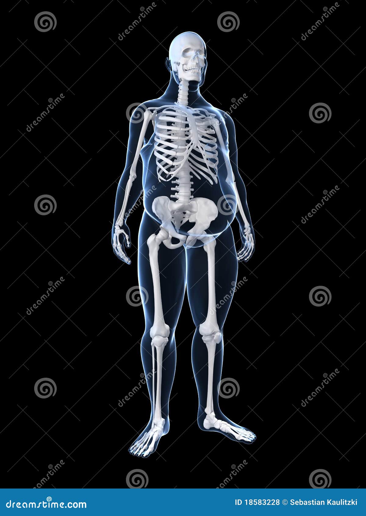 Overweight male - skeleton stock illustration. Illustration of pain ...