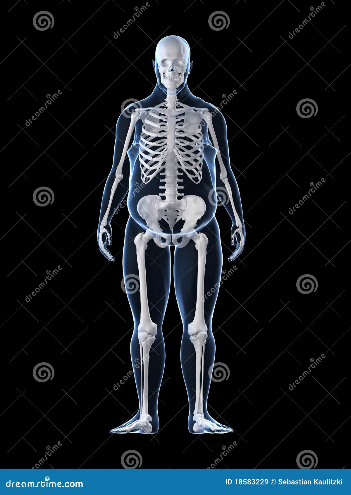 Overweight male - skeleton stock illustration. Illustration of painful ...