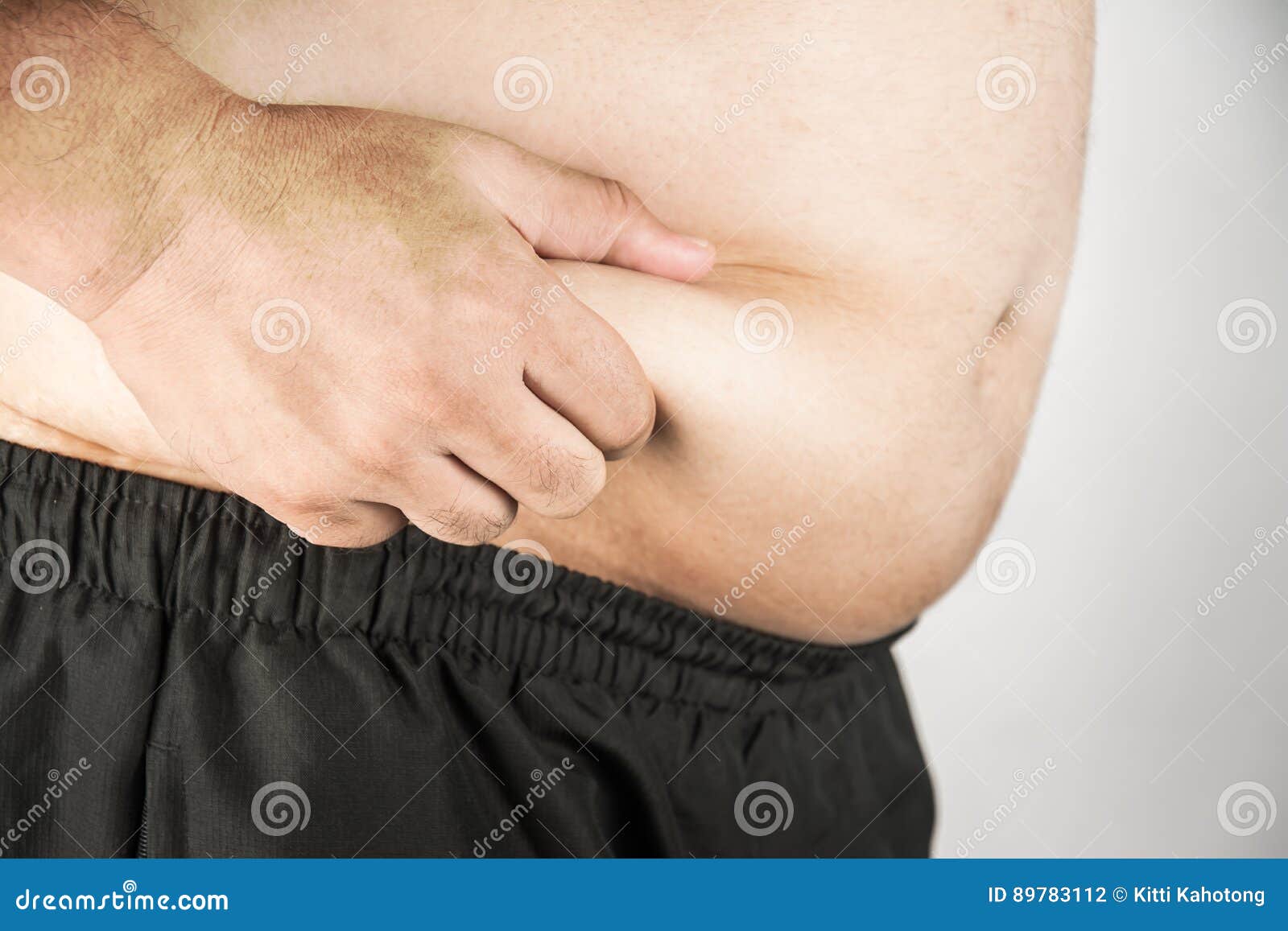 Overweight Man Body with Hands Touching Belly Fat Stock Photo - Image ...