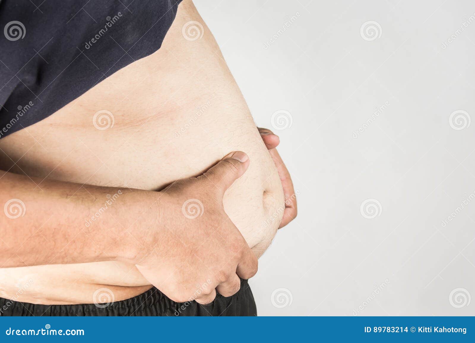 Overweight Man Body with Hands Touching Belly Fat Stock Photo - Image ...