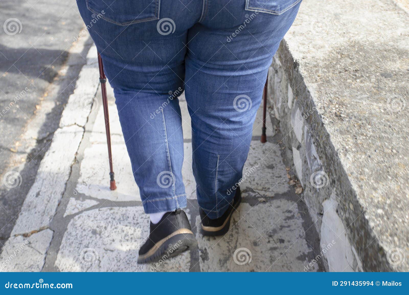 Overweight Woman with Walking Difficulties Walks with the Help of ...