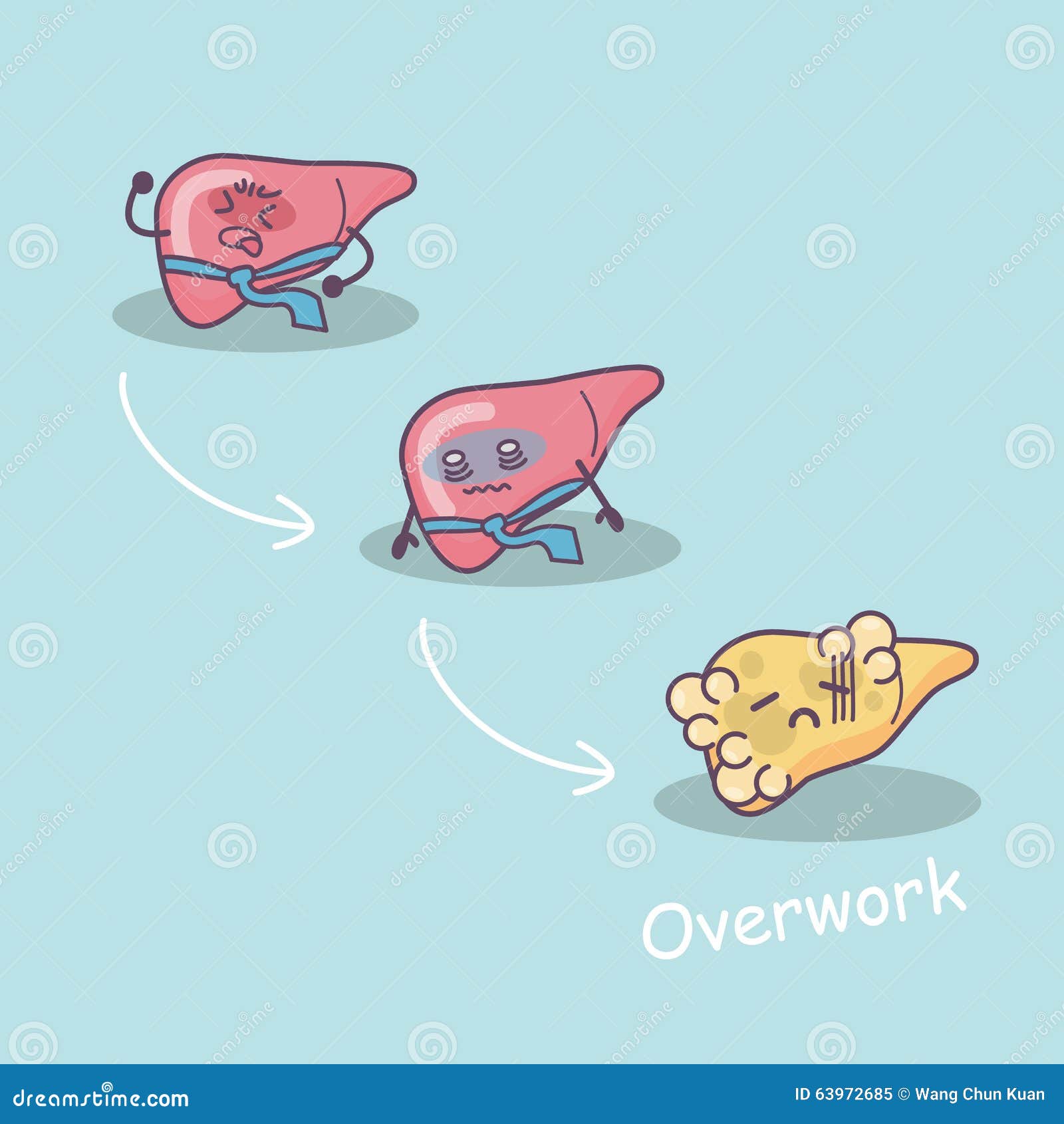 Overwork damage liver stock vector. Illustration of hepatic - 63972685