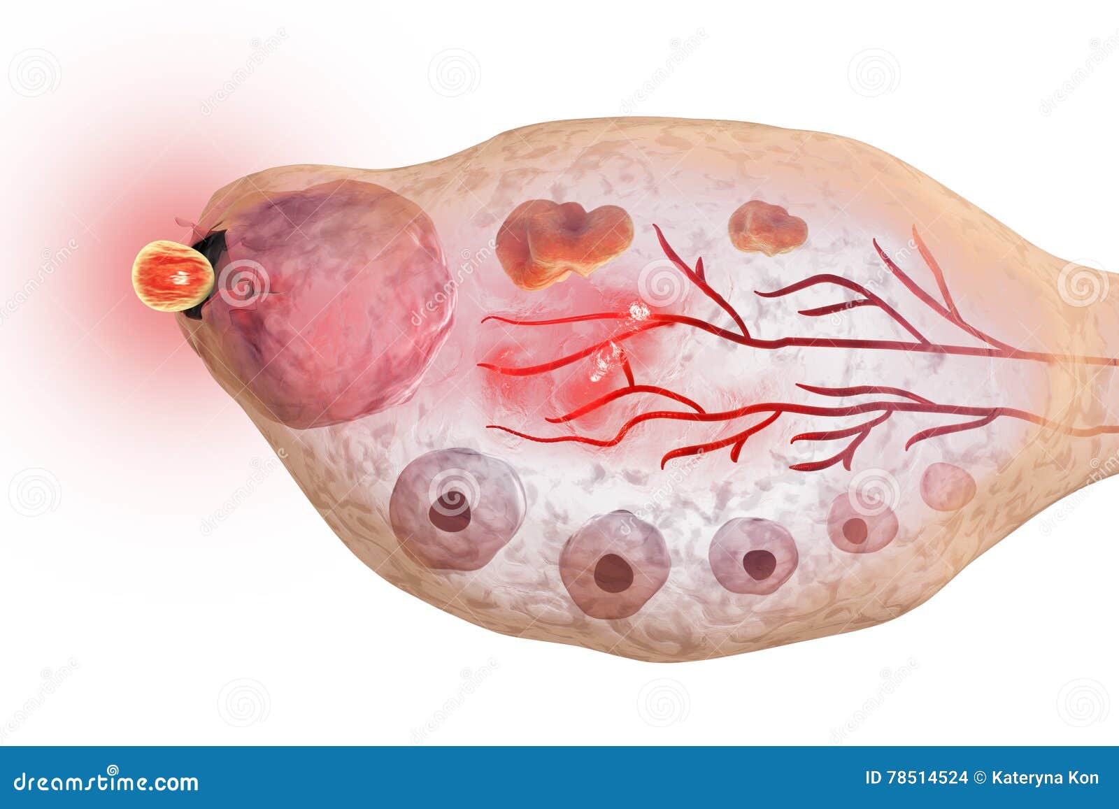 Ovulation In Female Ovary Stock Illustration Illustration Of Medical