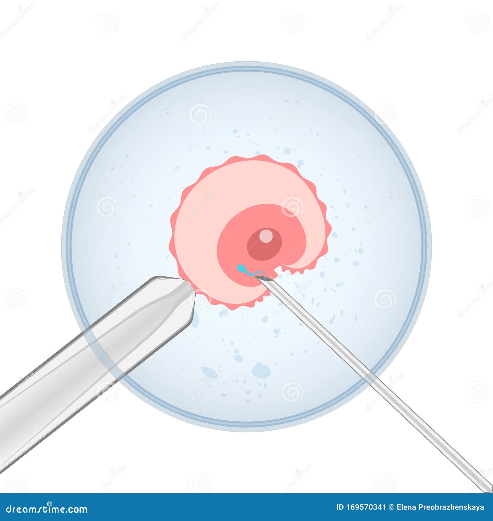 Ovum and Sperm on a Needle Under a Microscope. Artificial Insemination ...