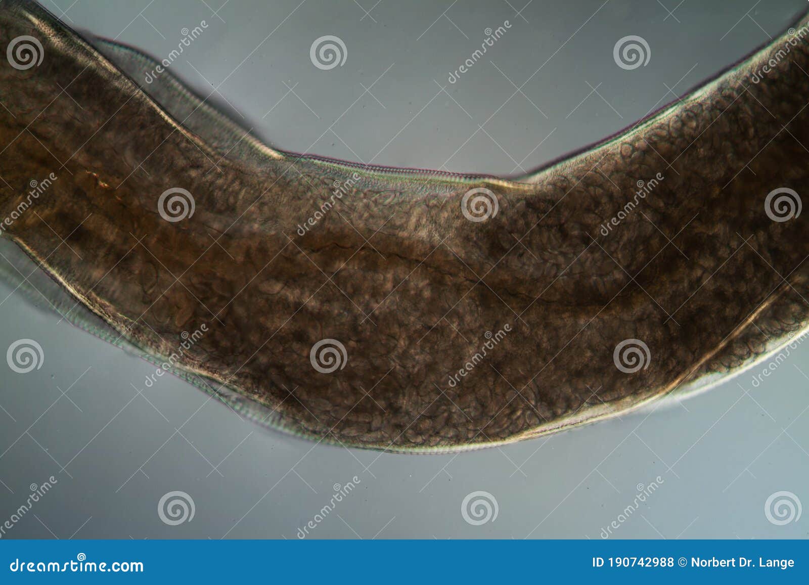 Pinworm Infection Sign On The Sheet Stock Photography | CartoonDealer ...