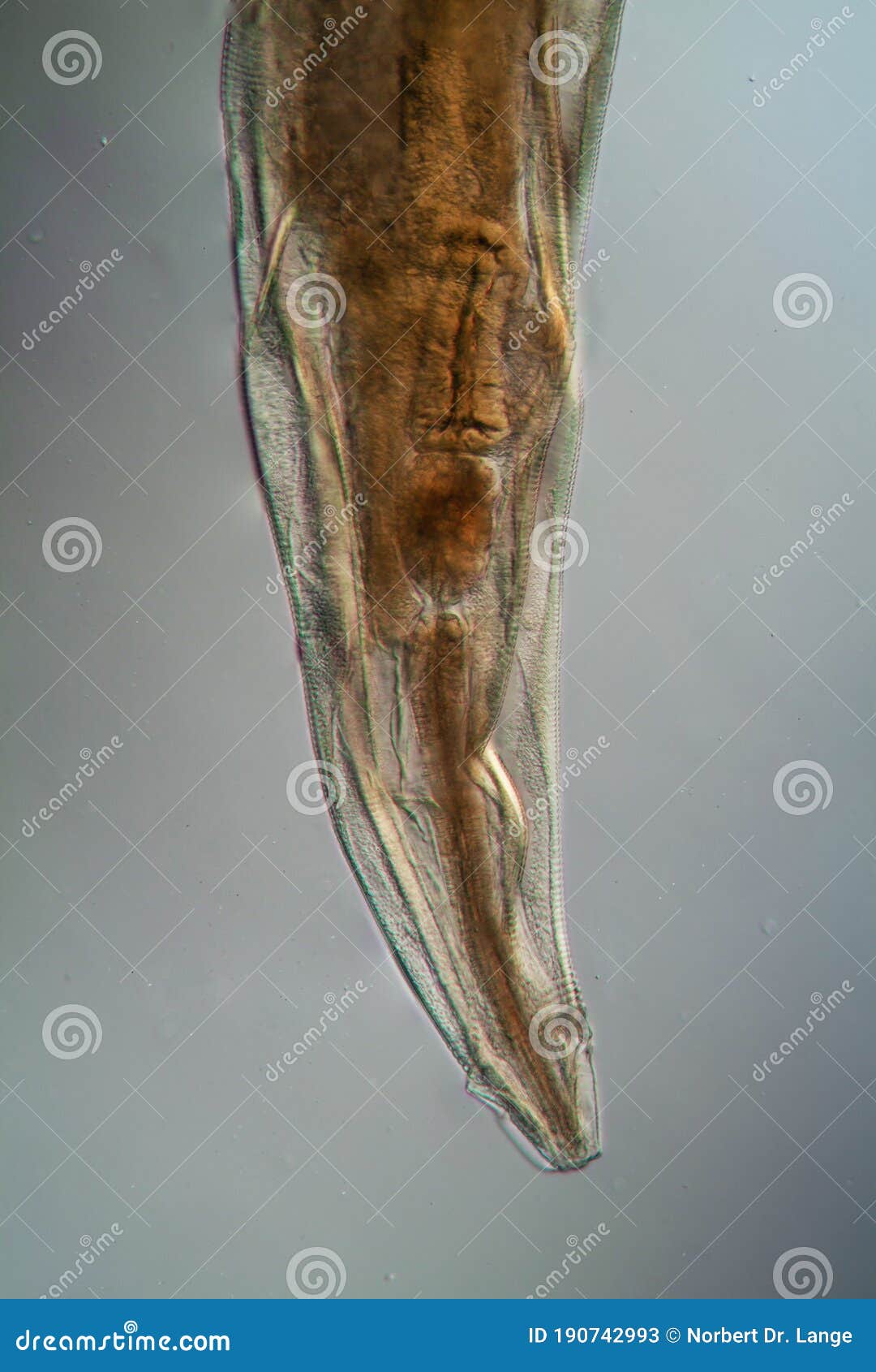Pinworm Infection Sign On The Sheet Stock Photography | CartoonDealer ...