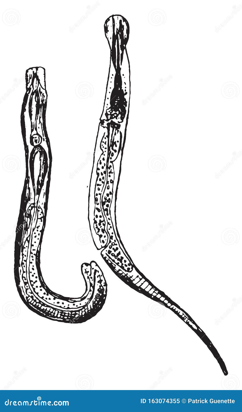 Oxyuris Vermicularis, Vintage Engraving Stock Vector - Illustration of ...