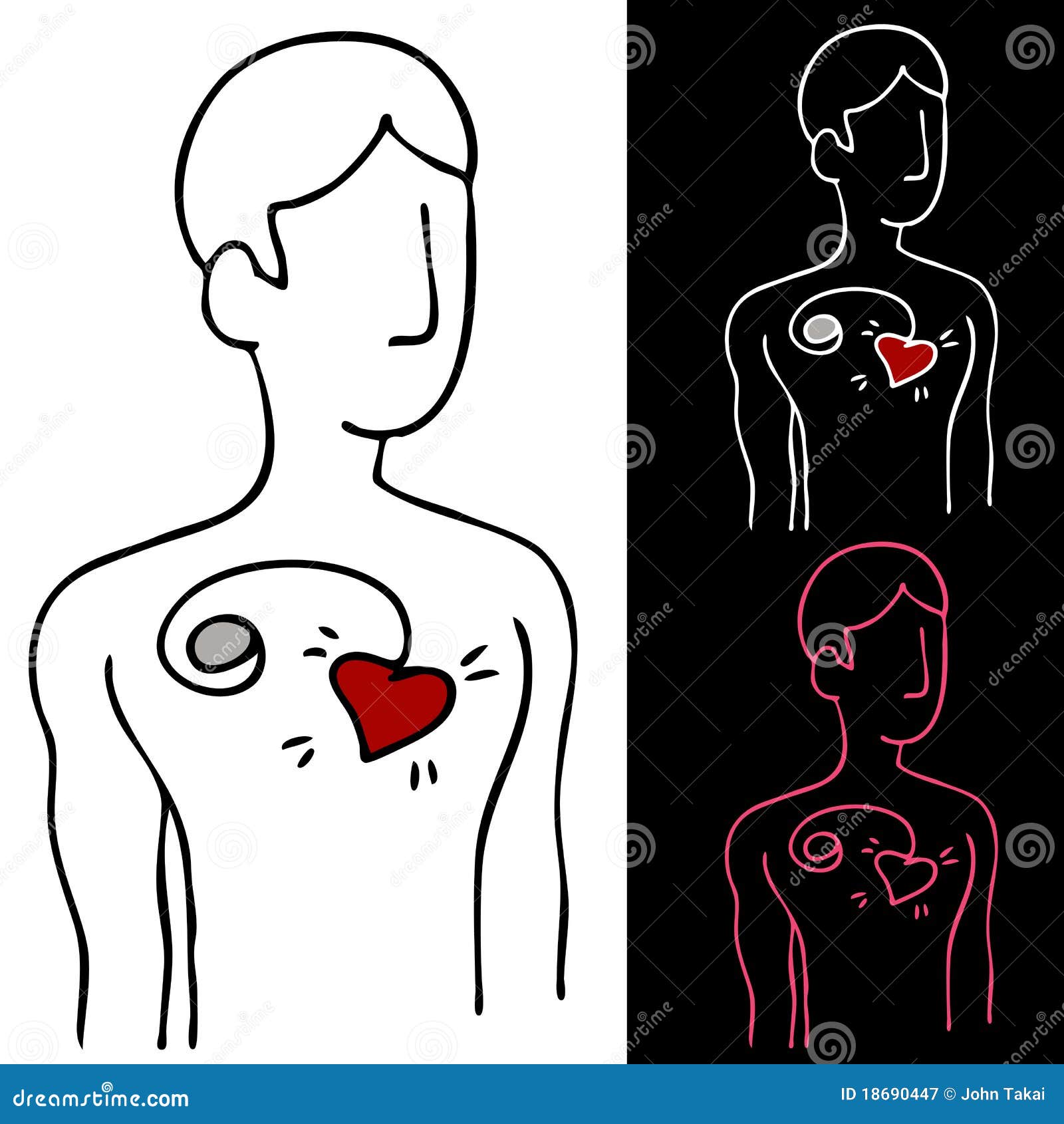 Pacemaker stock vector. Illustration of drawing, attack - 18690447