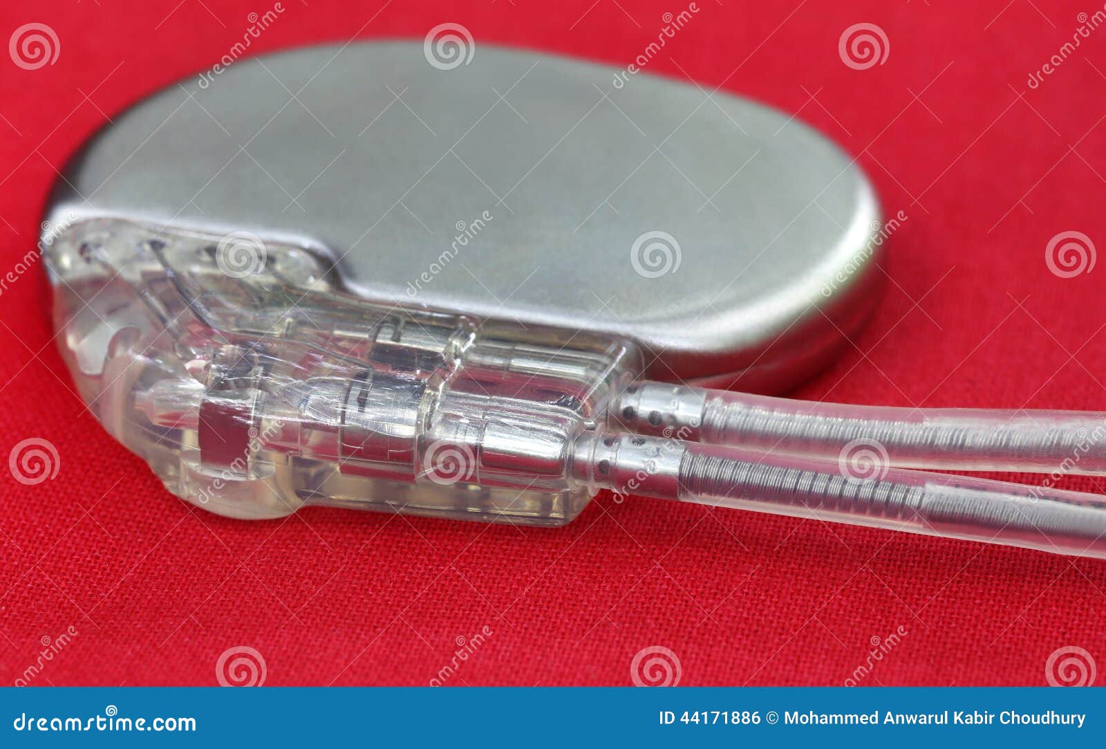 Pacemaker with Electrical Leads Stock Photo - Image of pacemaker, life ...