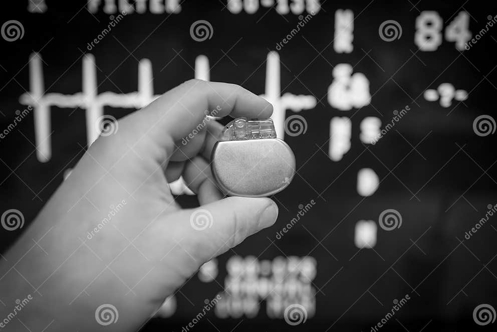 An Pacemaker is Held in Front of an ECG Monitor Stock Photo - Image of ...