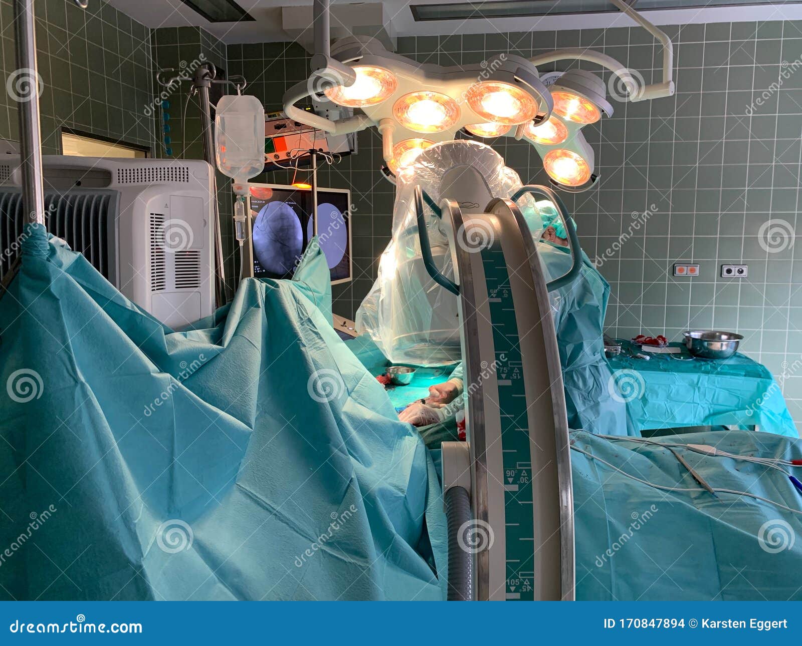 Pacemaker Operation is Performed in an Operating Theatre Editorial ...