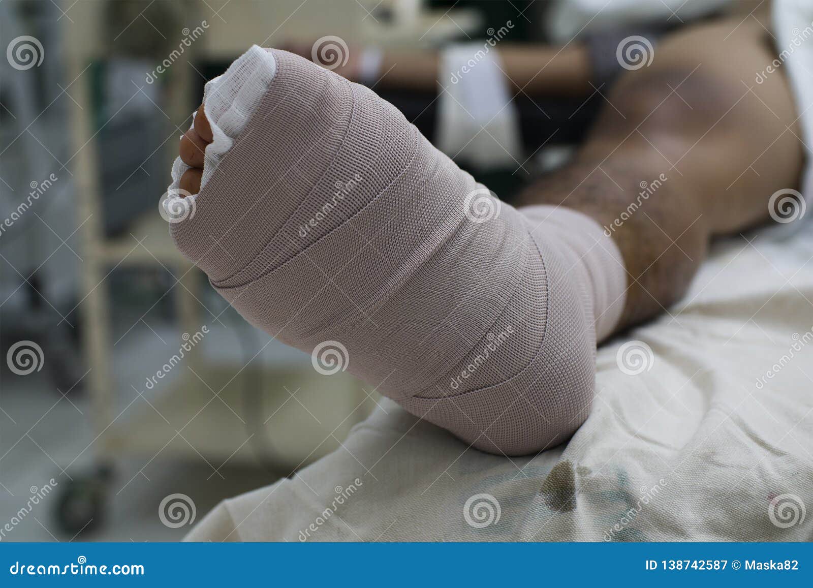 Paciente Con El Pie Diabético Infectado Imagen de archivo - Imagen de ...