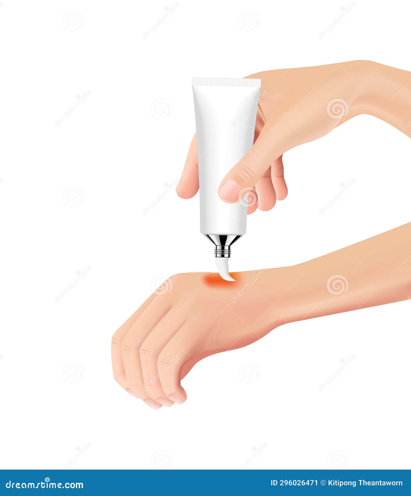 Skin Burn Injury Treatment. First Aid for Burn Wound Vector ...