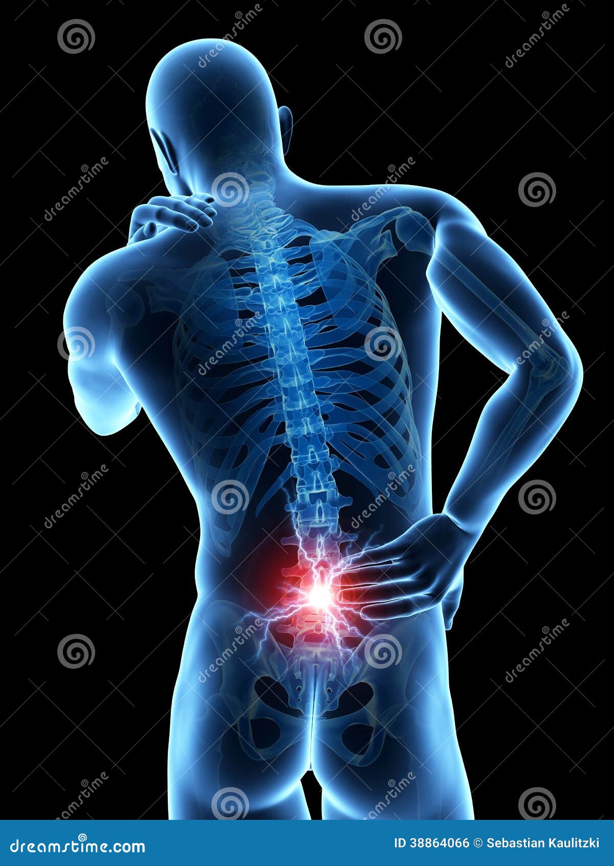 Pain In Back, Stretching Tension Or Protrusion, Herniated Disc Vector ...
