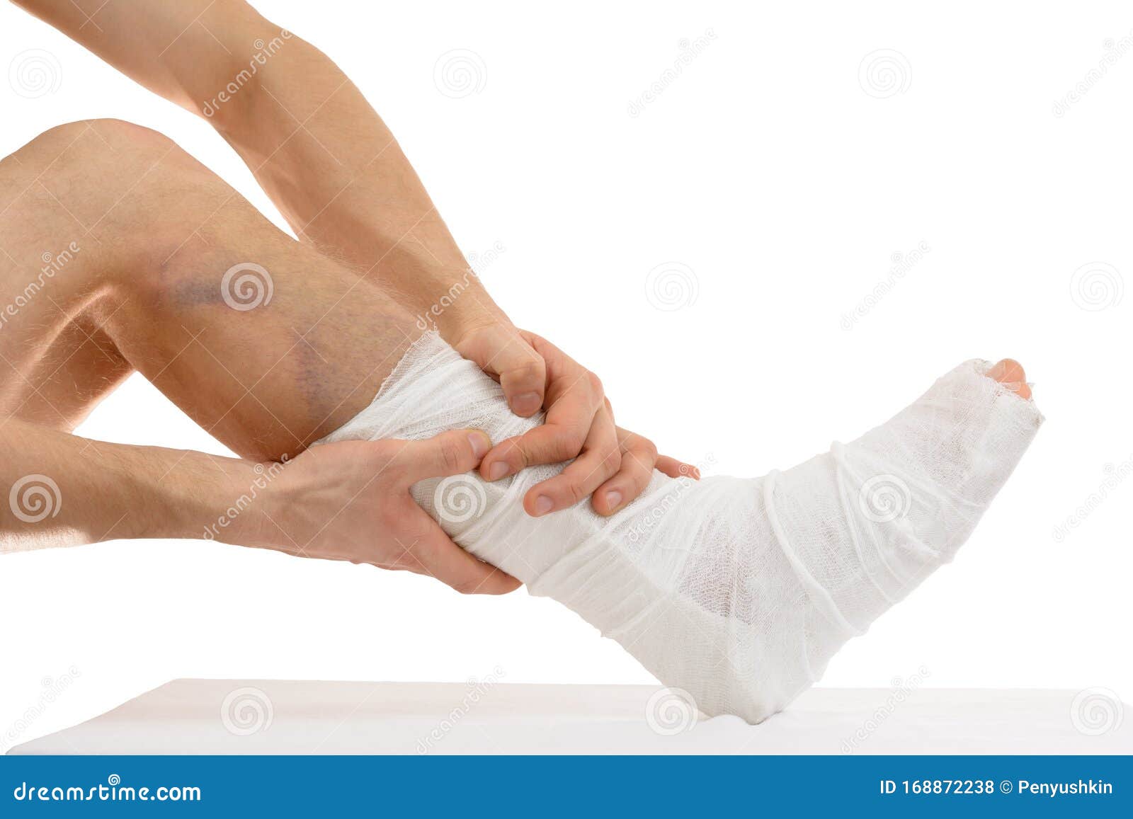 Pain in broken leg stock photo. Image of bandage, ankle - 168872238