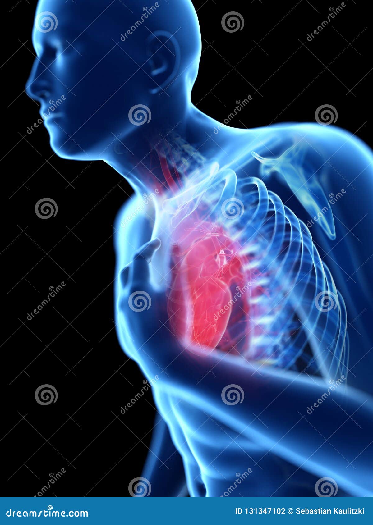 Chest Cramp Stock Illustrations – 285 Chest Cramp Stock Illustrations ...