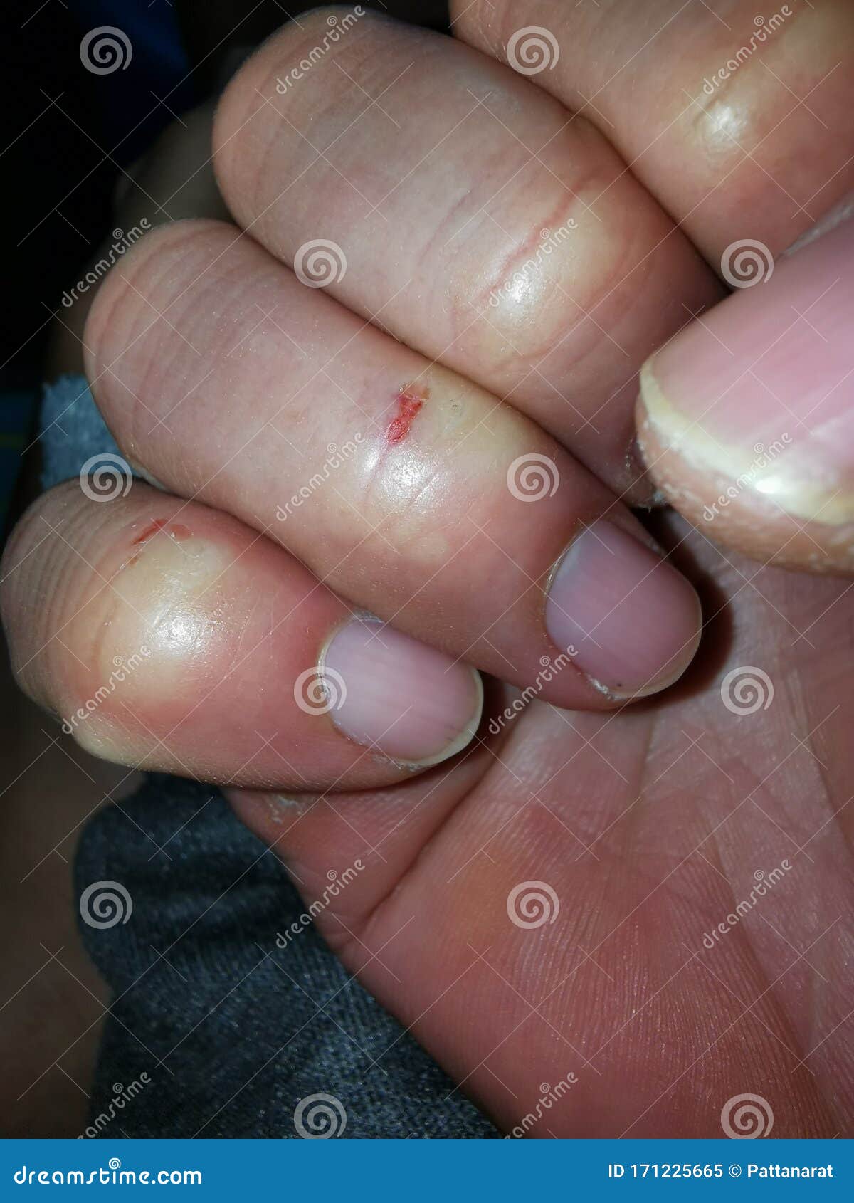 Pain Hand Closeup Fingers Punch Stock Image - Image of punch, hand ...