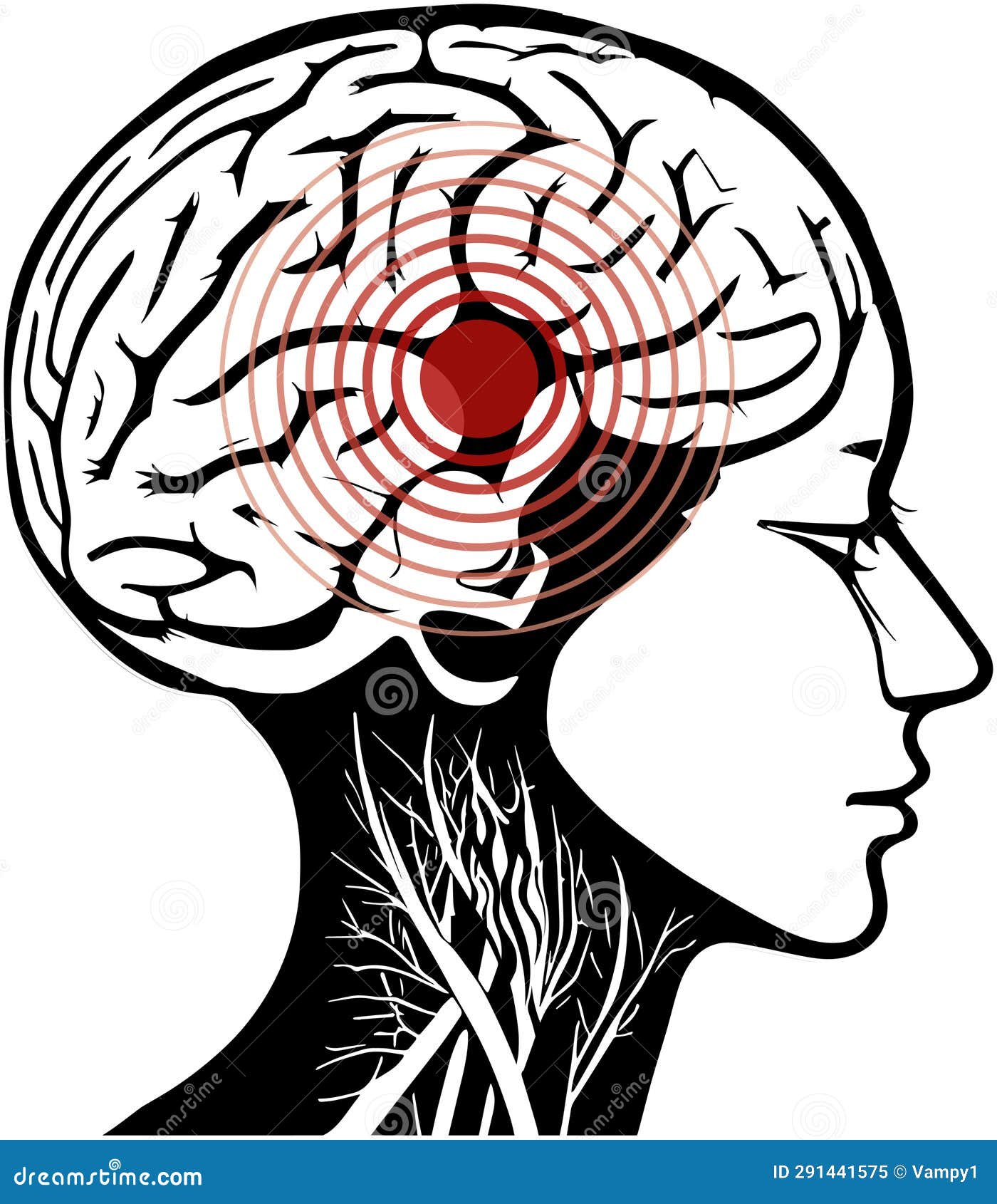 Pain In The Head, Brain And Synapses, Cognitive Problems, Mental ...