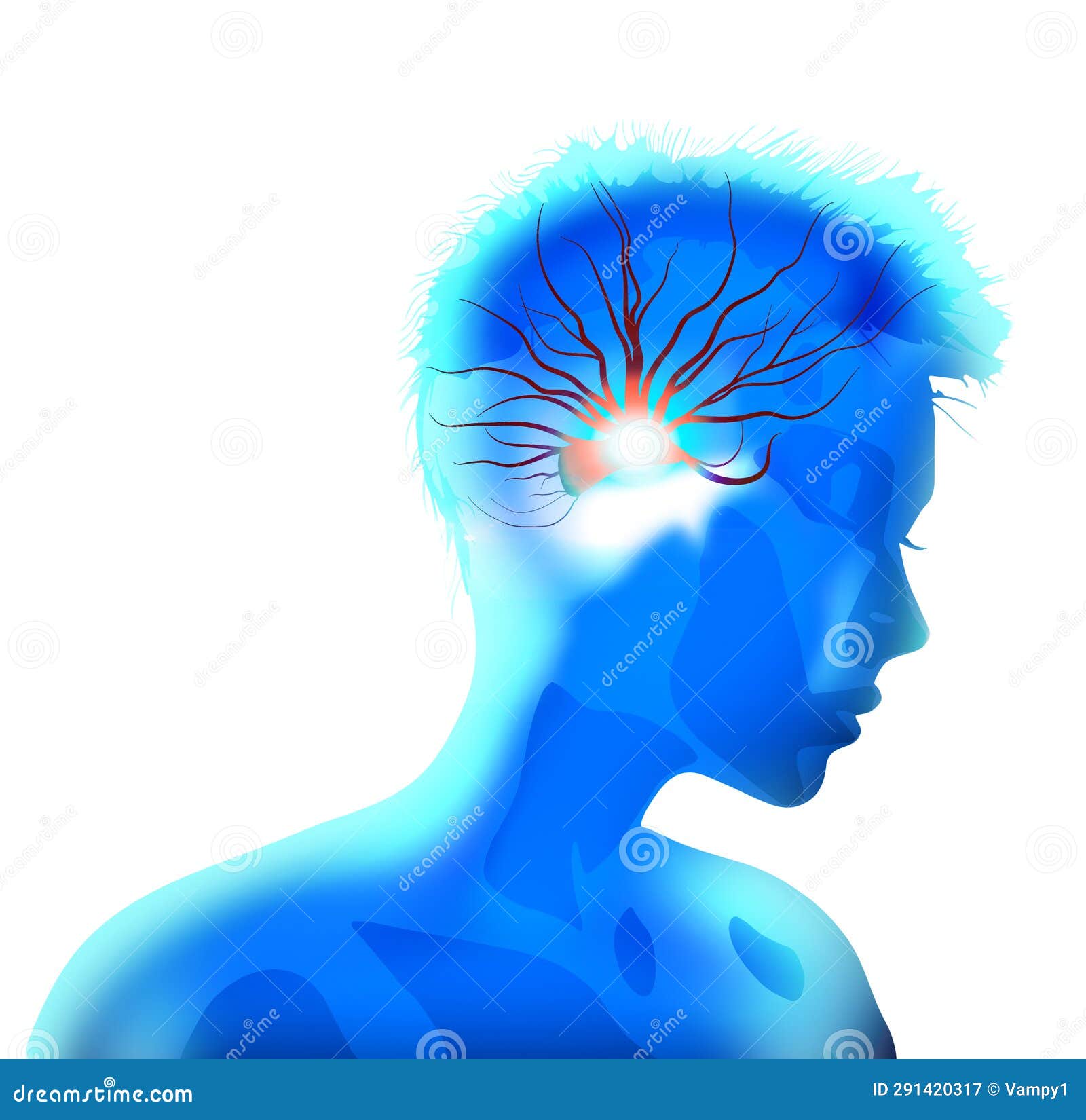 Pain in the Head, Brain and Synapses, Cognitive Problems, Mental ...