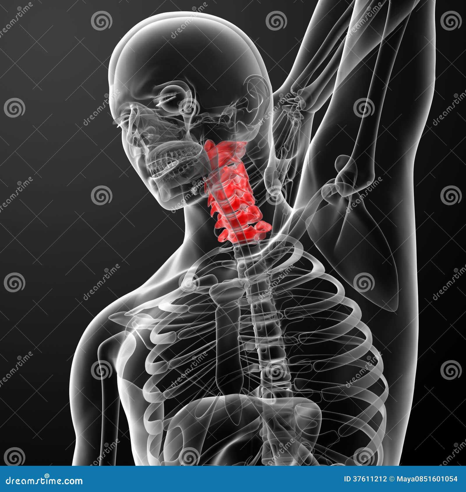 Pain In The Neck X-ray Scan Rear View Royalty-Free Stock Image ...