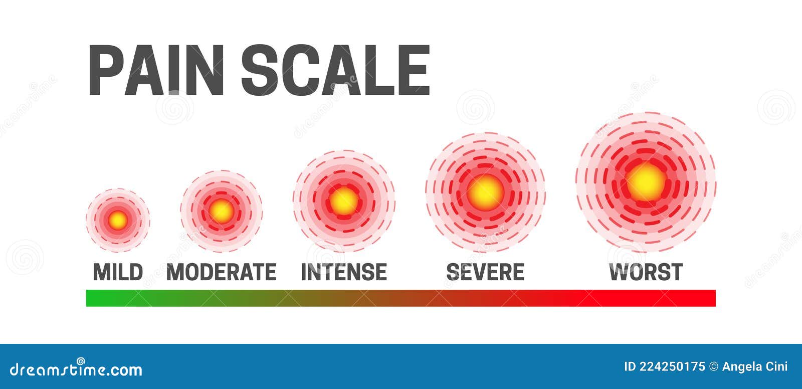 Pain Scale Infographic Vector Illustration Stock Vector - Illustration ...