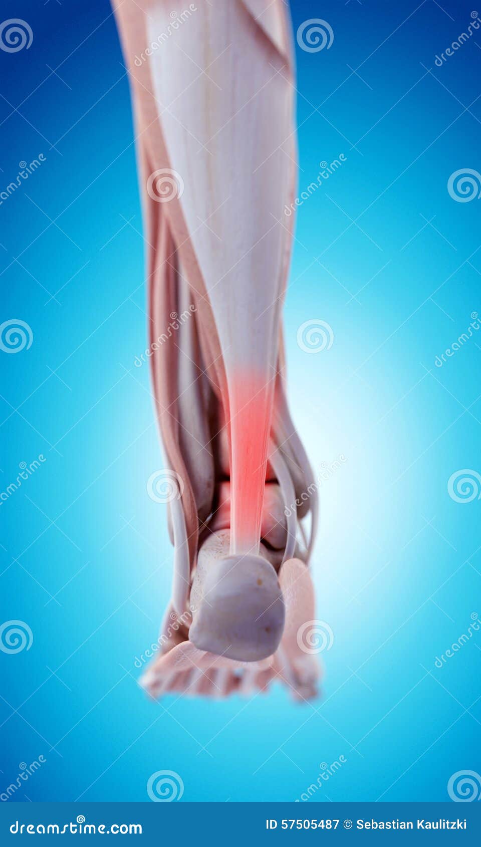 Painful Achilles Tendon Royalty-Free Cartoon | CartoonDealer.com #57505487