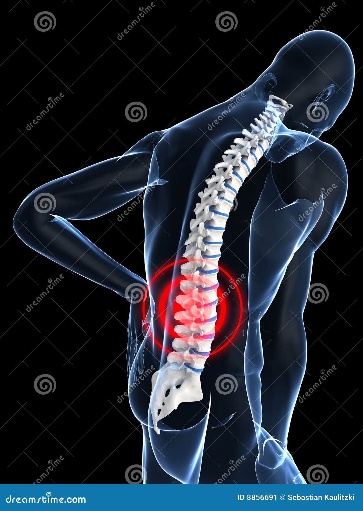 Painful back stock illustration. Illustration of osteoporosis - 8856691